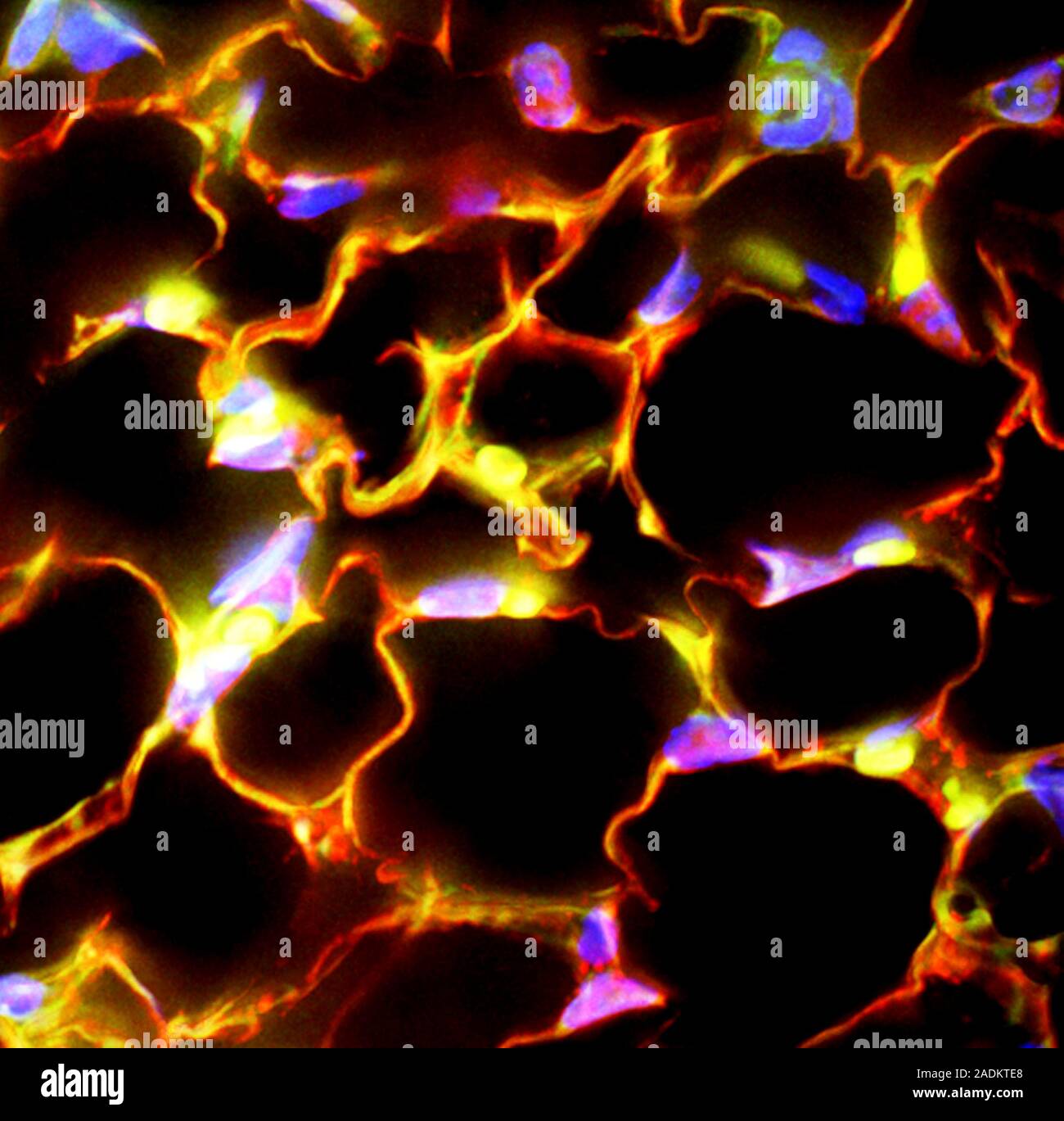 Fat cells, fluorescence deconvolution micrograph. Fluorescent dyes have ...