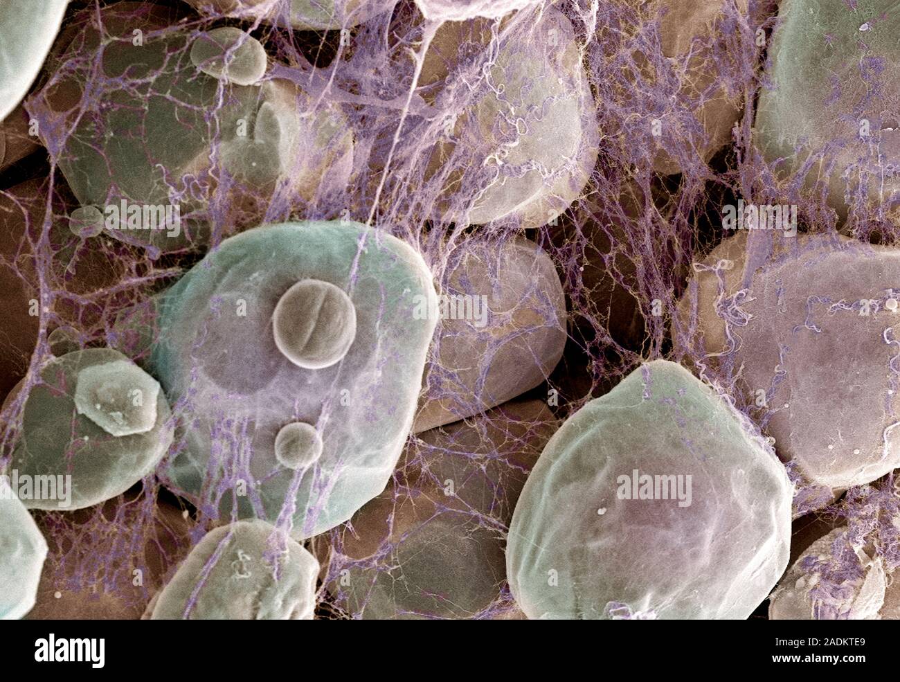 Fat tissue, coloured scanning electron micrograph (SEM). Fat tissue ...