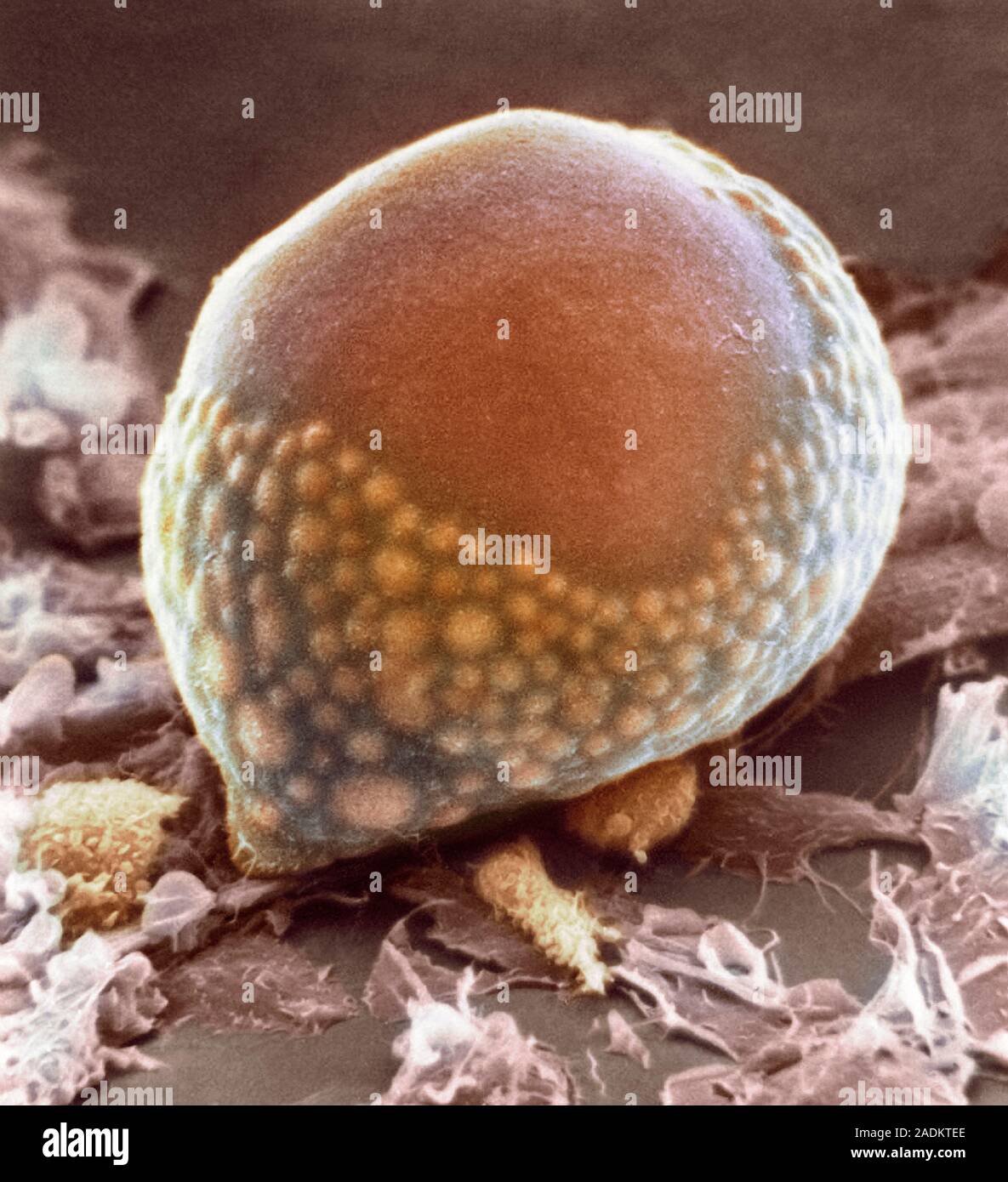 Fat cell. Coloured scanning electron micrograph (SEM) of an adipocyte ...