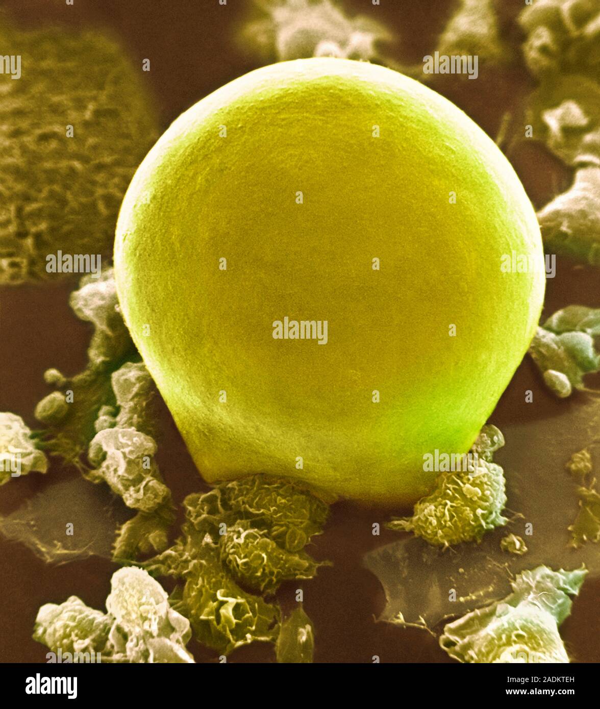 Fat cell. Coloured scanning electron micrograph (SEM) of an adipocyte ...
