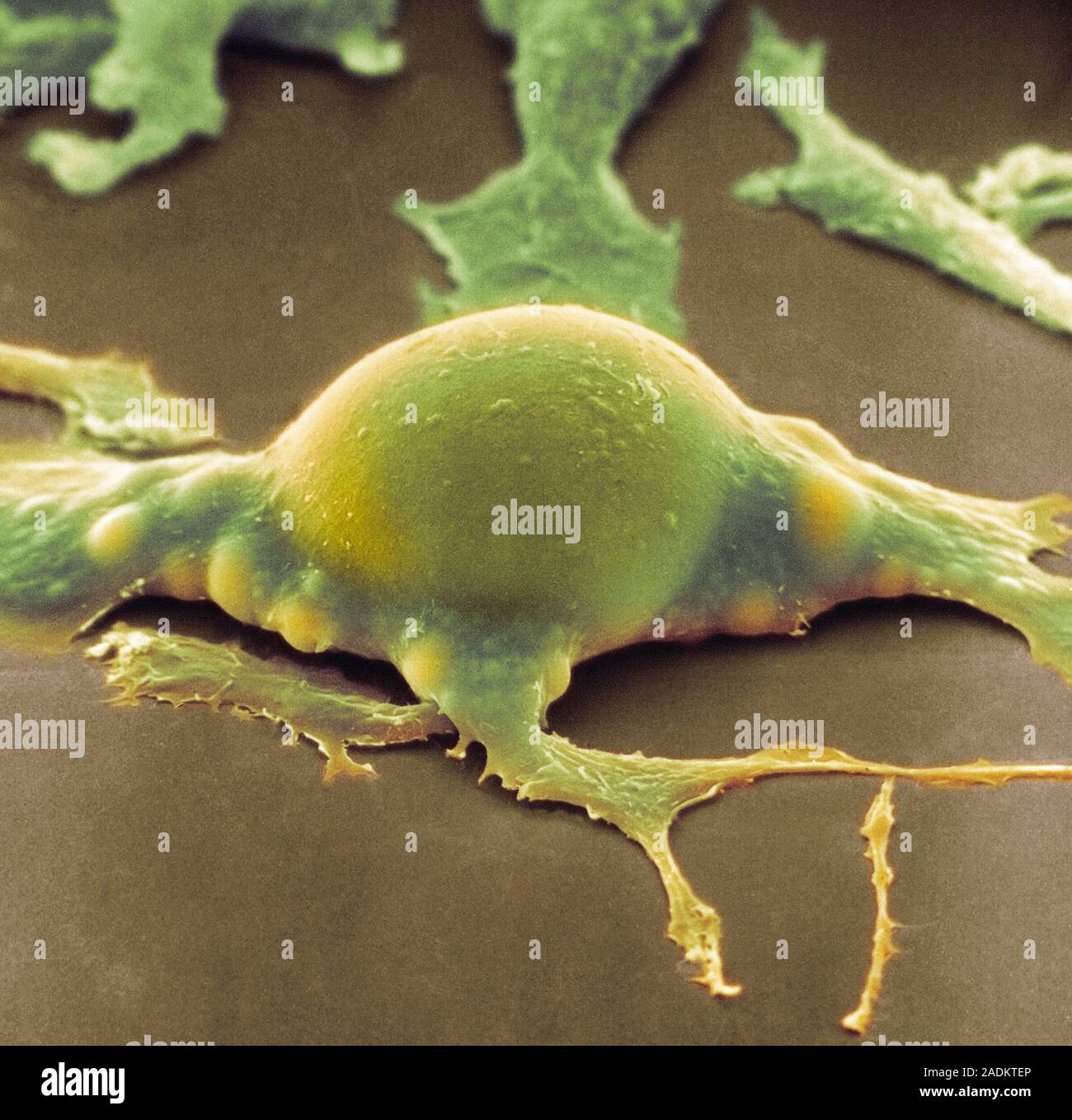 Fat cell. Coloured scanning electron micrograph (SEM) of a fat cell ...