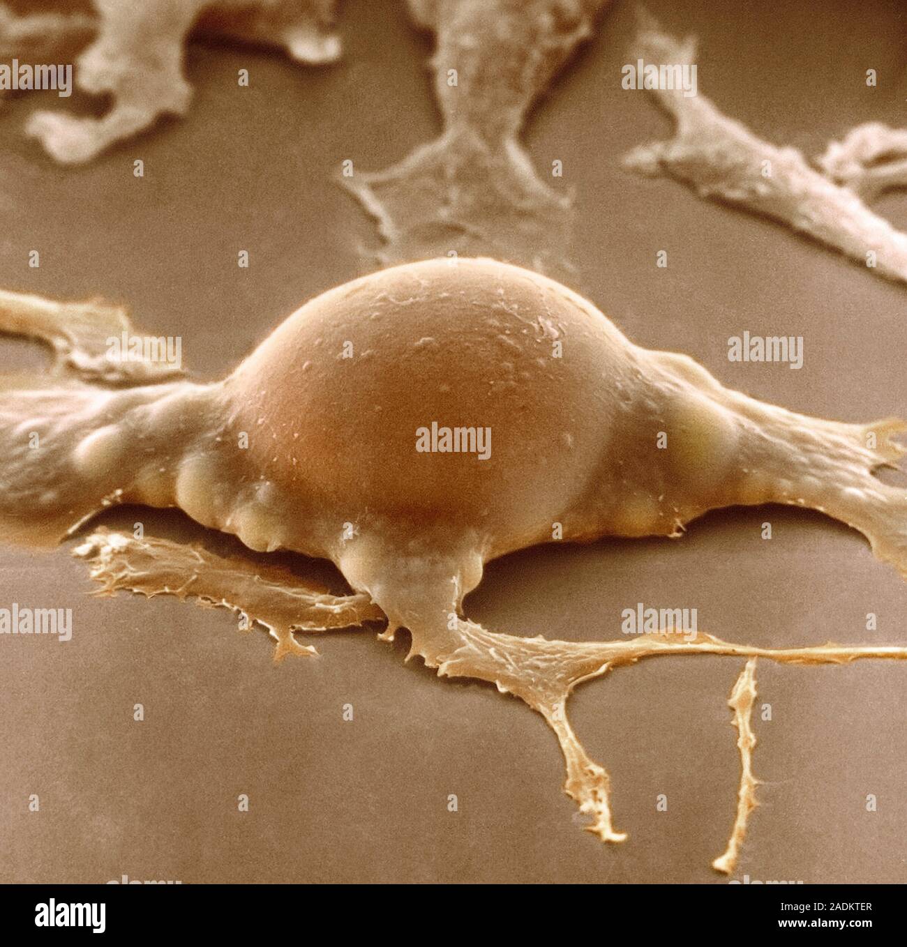 Fat cell. Coloured scanning electron micrograph (SEM) of a fat cell ...