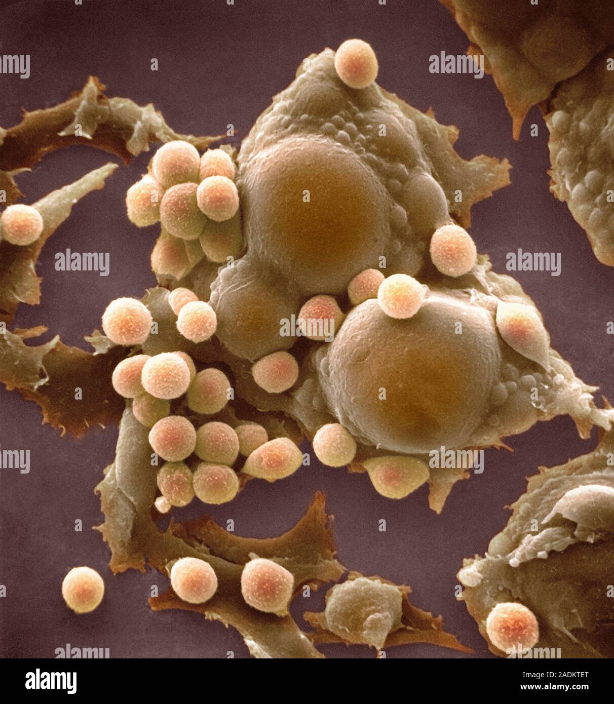 Fat Cells Coloured Scanning Electron Micrograph Sem Of Adipocytes Fat Cells Large Brown