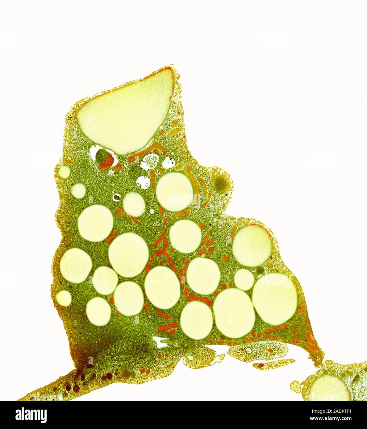 Fat cells. Coloured transmission electron micrograph (TEM) of a section ...