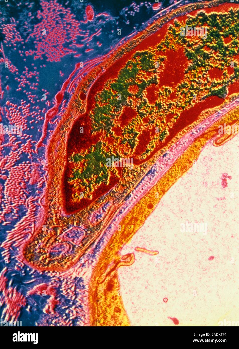 False-colour transmission electron micrograph of a fibroblast cell ...