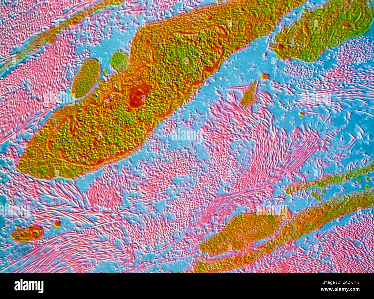 False-colour transmission electron micrograph (TEM) of a fibroblast ...
