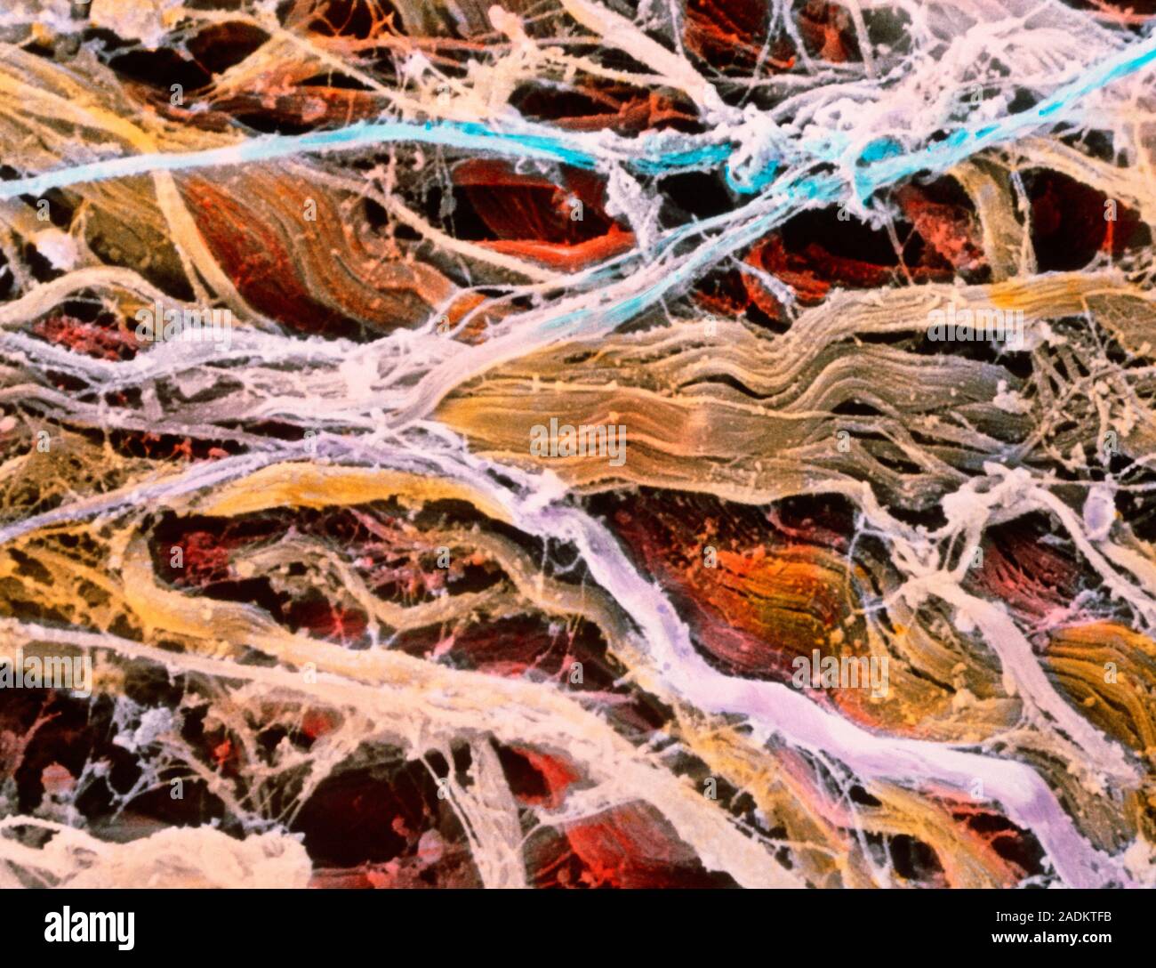 Connective tissue. False-colour scanning electron micrograph (SEM) of ...