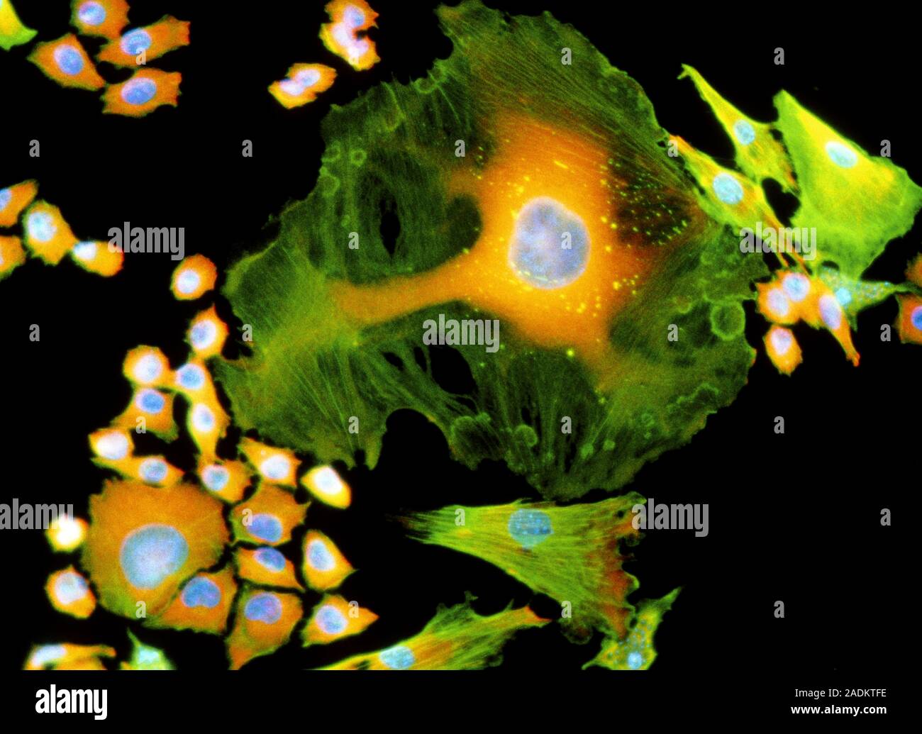 Immunofluorescent Light Micrograph of fibroblast connective tissue ...