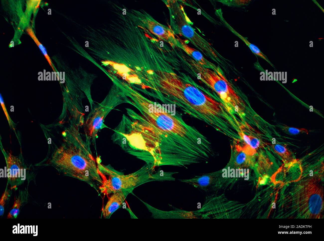 Fibroblast cells. Immunofluorescent light micrograph of fibroblast ...