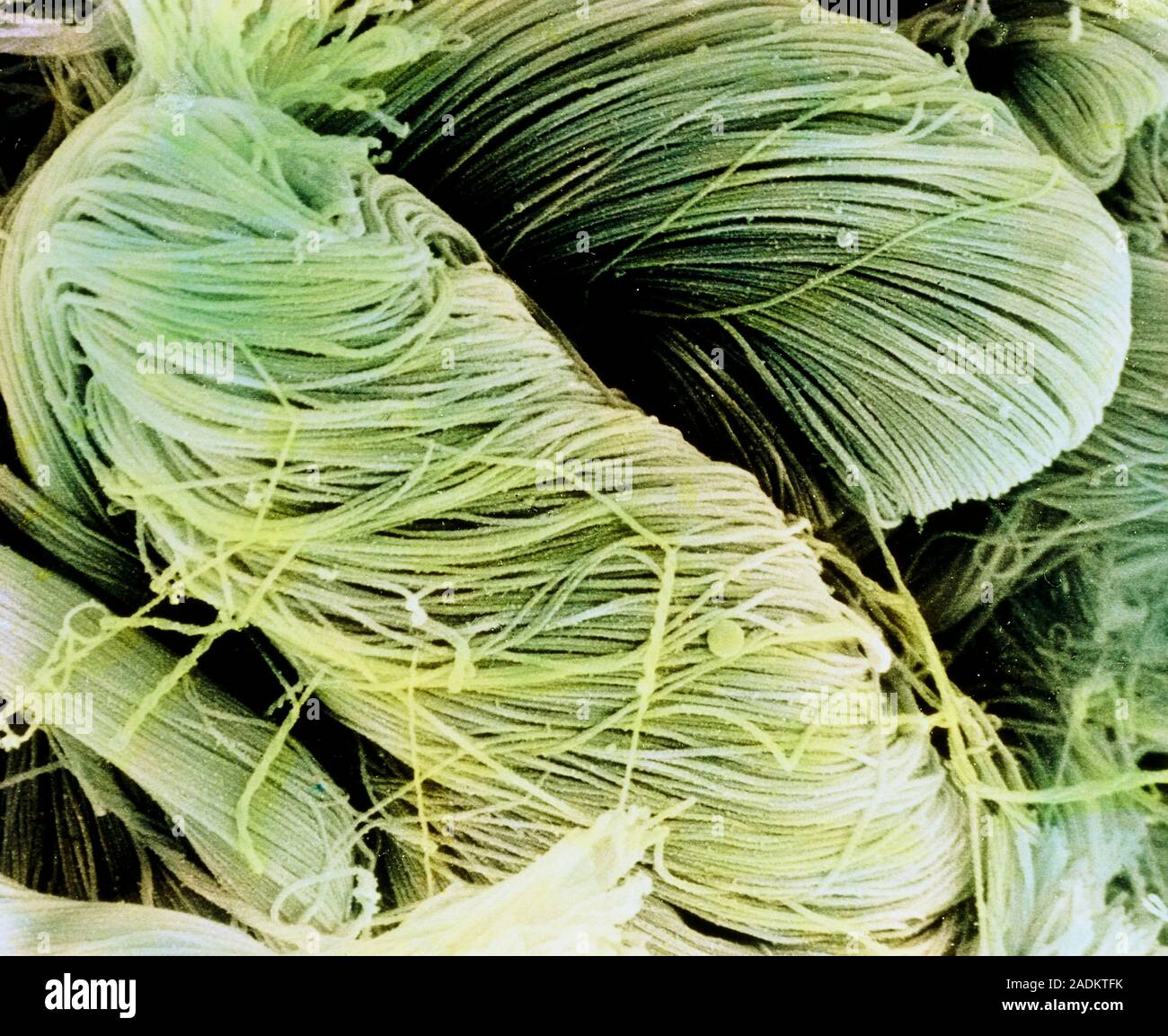 Collagen in the urinary bladder. Coloured Scanning Electron Micrograph ...