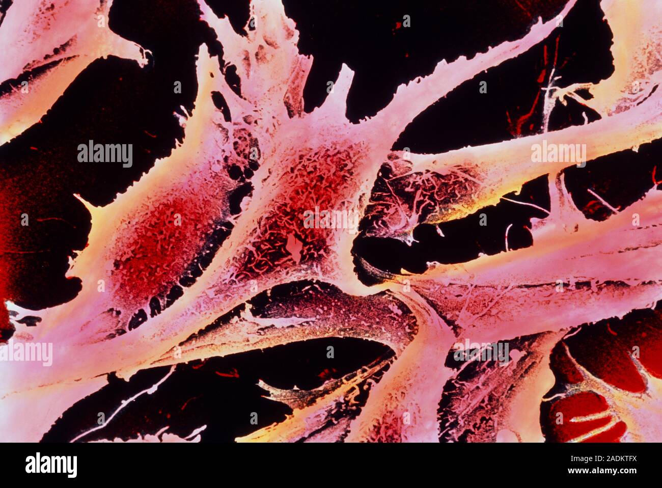 Fibroblast cells. Coloured scanning electron micrograph of fibroblast ...