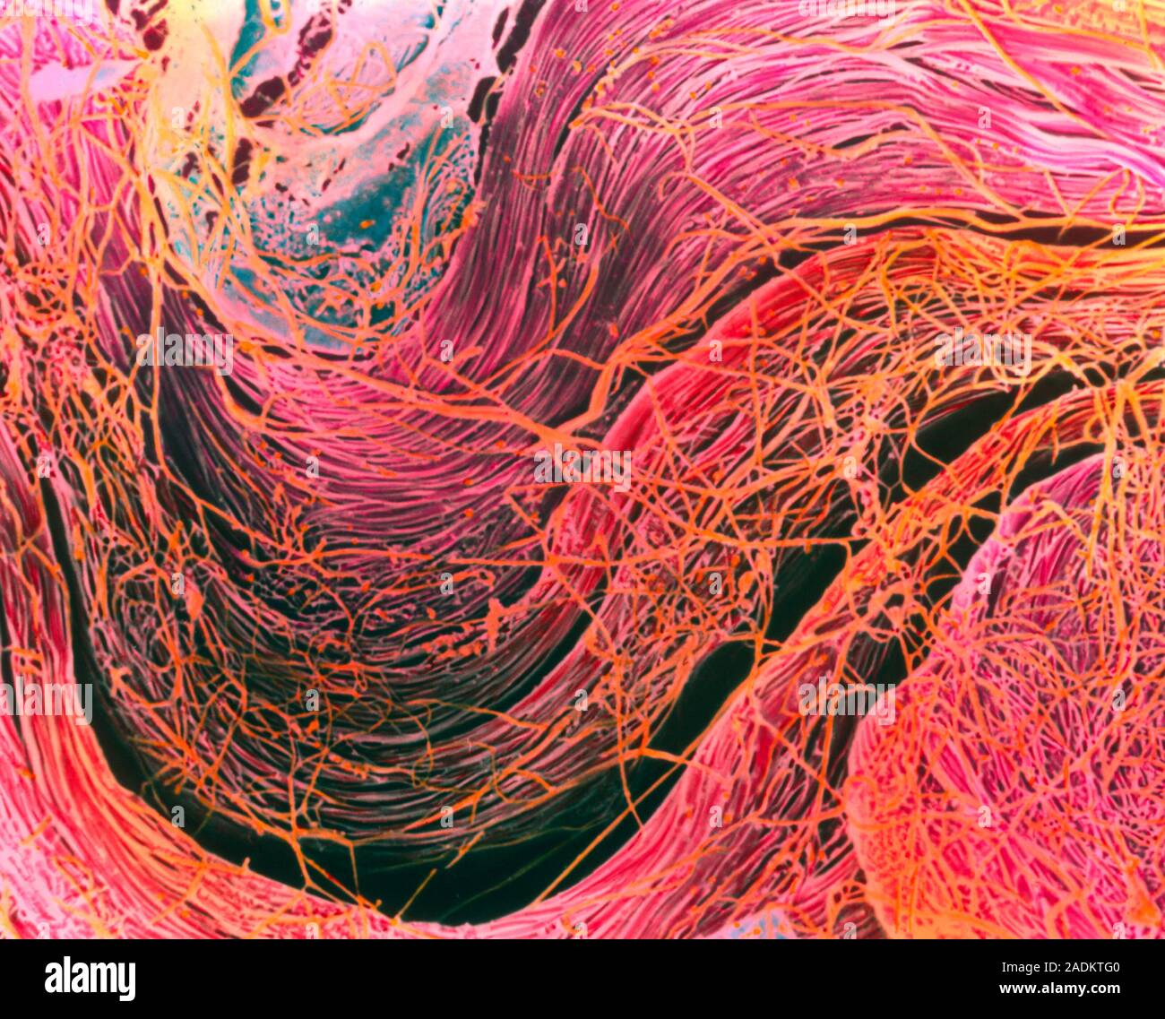 Connective tissue. Coloured scanning electron micrograph (SEM) of ...