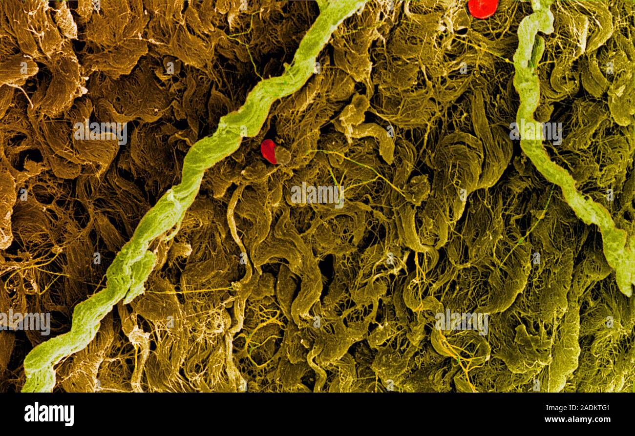 Collagen connective tissue. Scanning electron micrograph (SEM) of ...