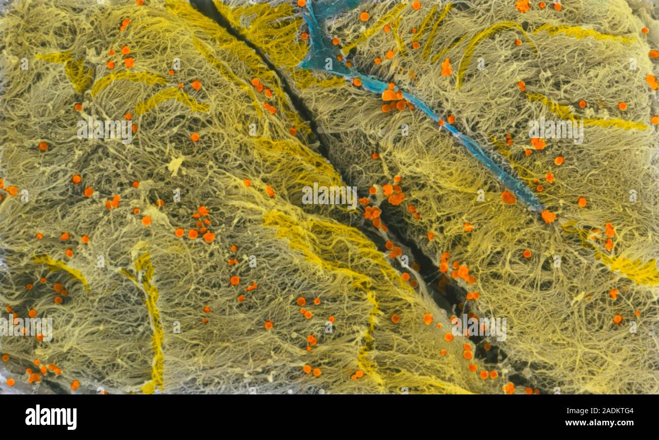 Collagen fibres. Coloured scanning electron micro- graph (SEM) of ...