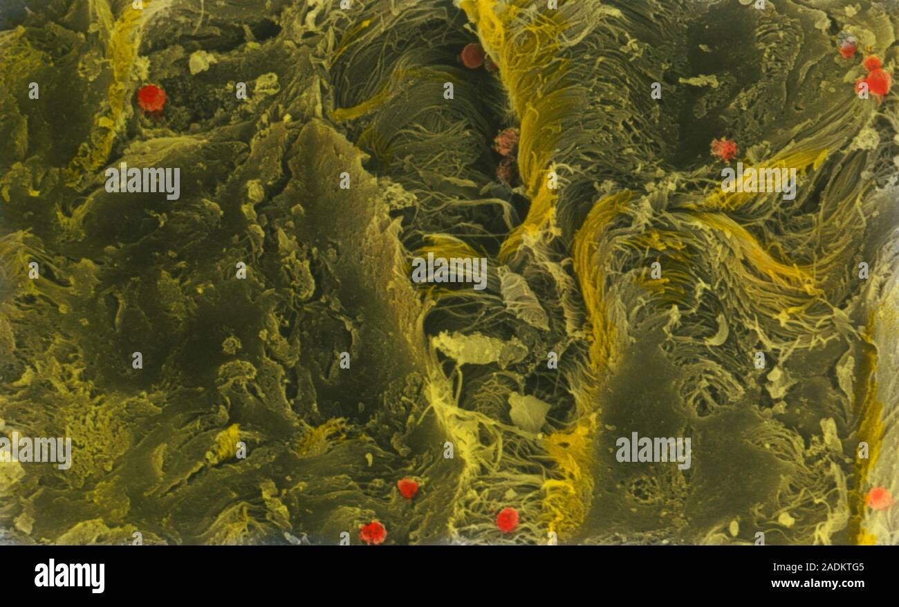 Collagen fibres. Coloured scanning electron micro- graph (SEM) of ...