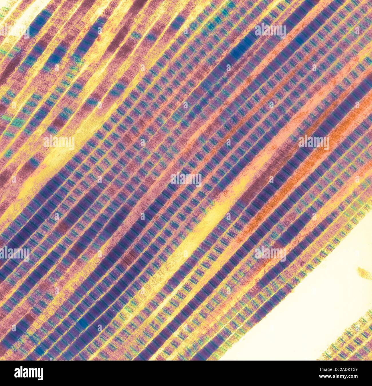 Collagen fibres. Coloured transmission electron micrograph (TEM) of a ...
