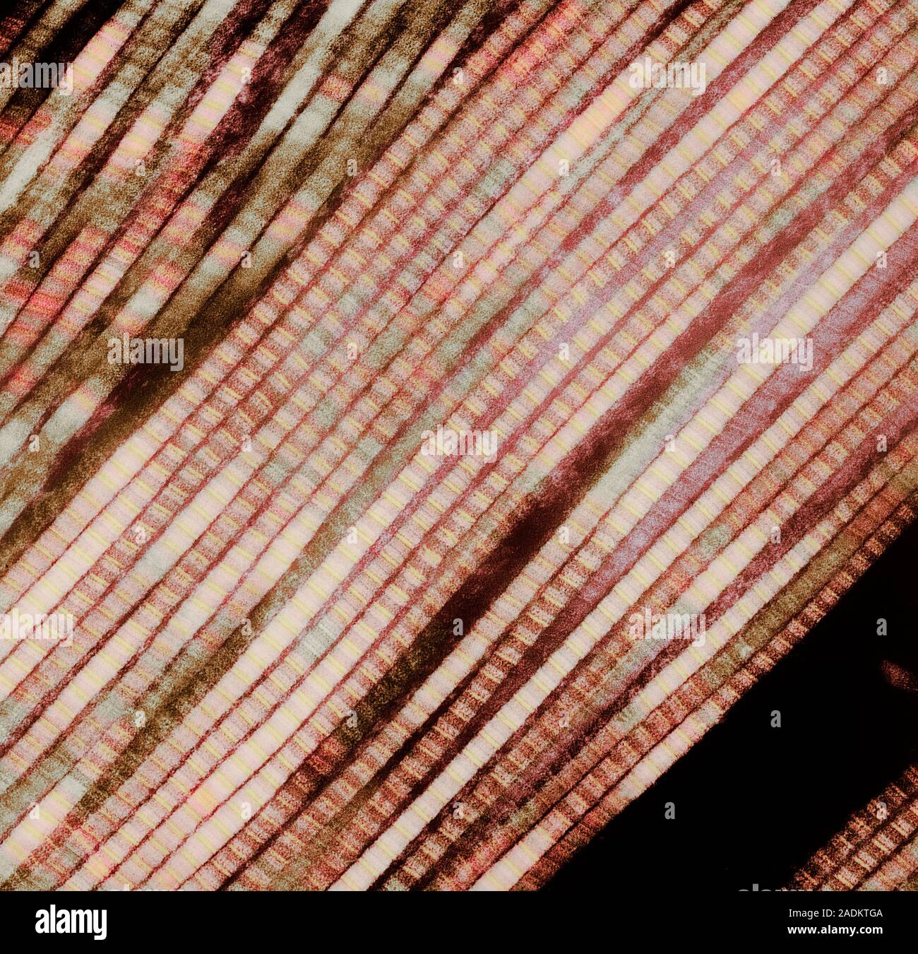 Collagen fibres. Coloured transmission electron micrograph (TEM) of a ...