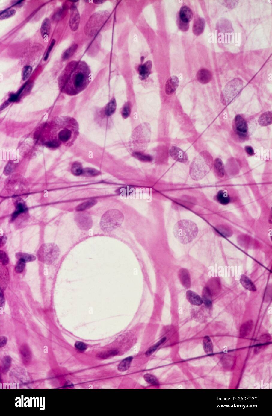 Areolar connective tissue, light micrograph. This is the most abundant ...