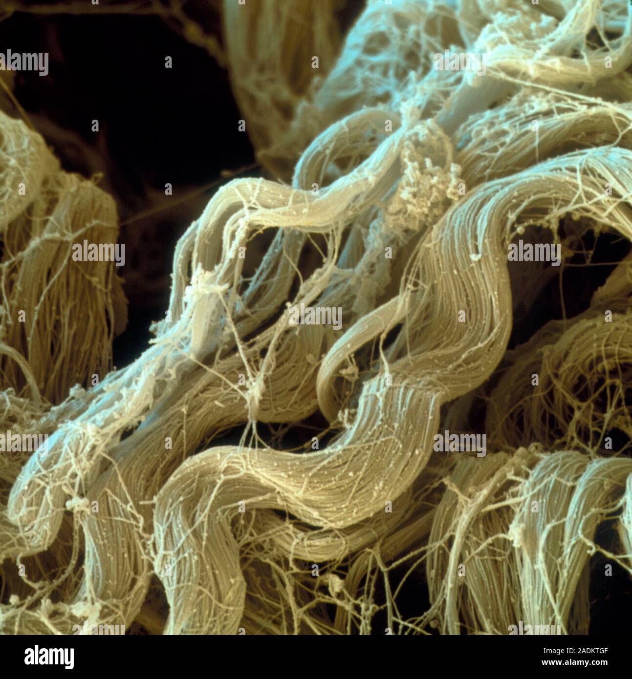 Connective tissue. Coloured scanning electron micrograph (SEM) of ...
