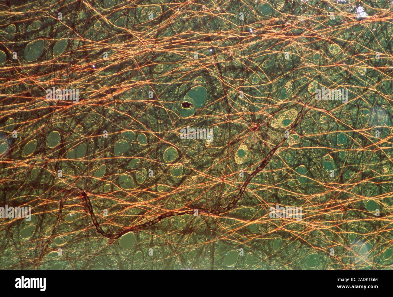 Elastic fibres. Light micrograph of elastic fibres (gold) in a sample ...
