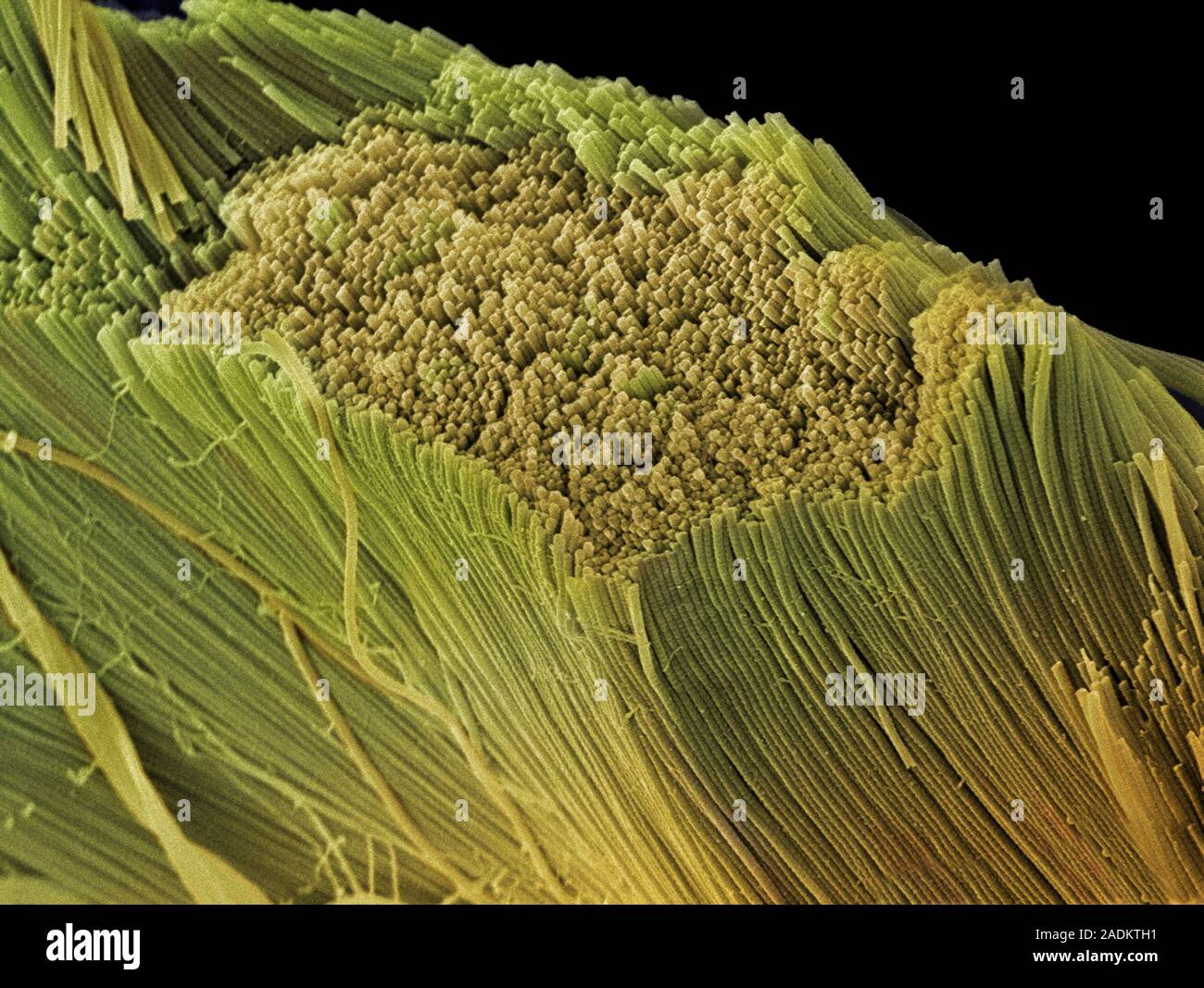 Collagen bundles. Scanning electron micrograph (SEM) of collagen ...