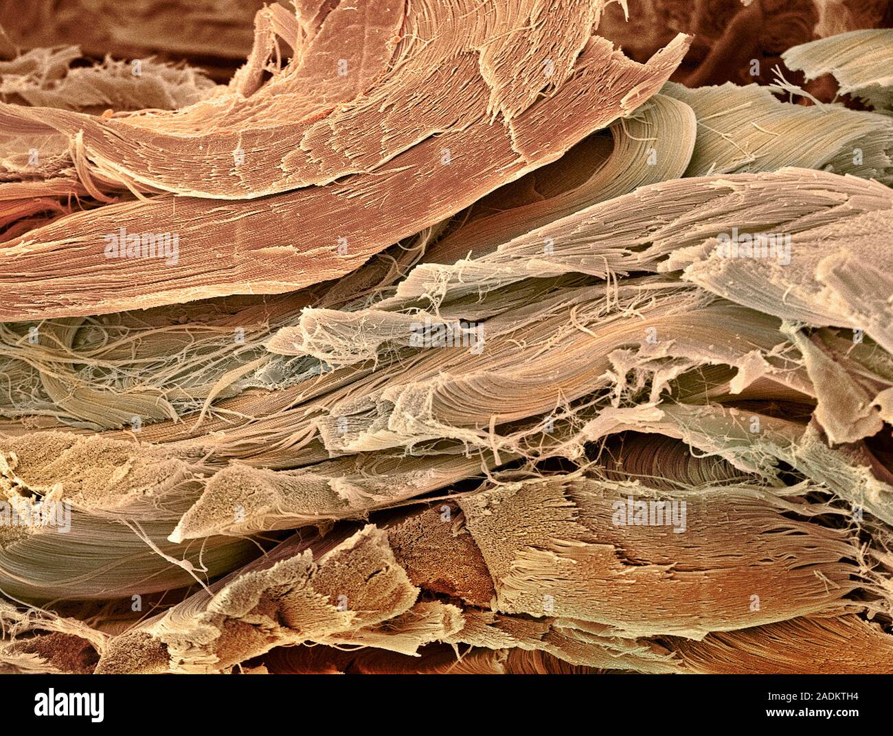 Neural connective tissue. Scanning electron micrograph (SEM) of ...
