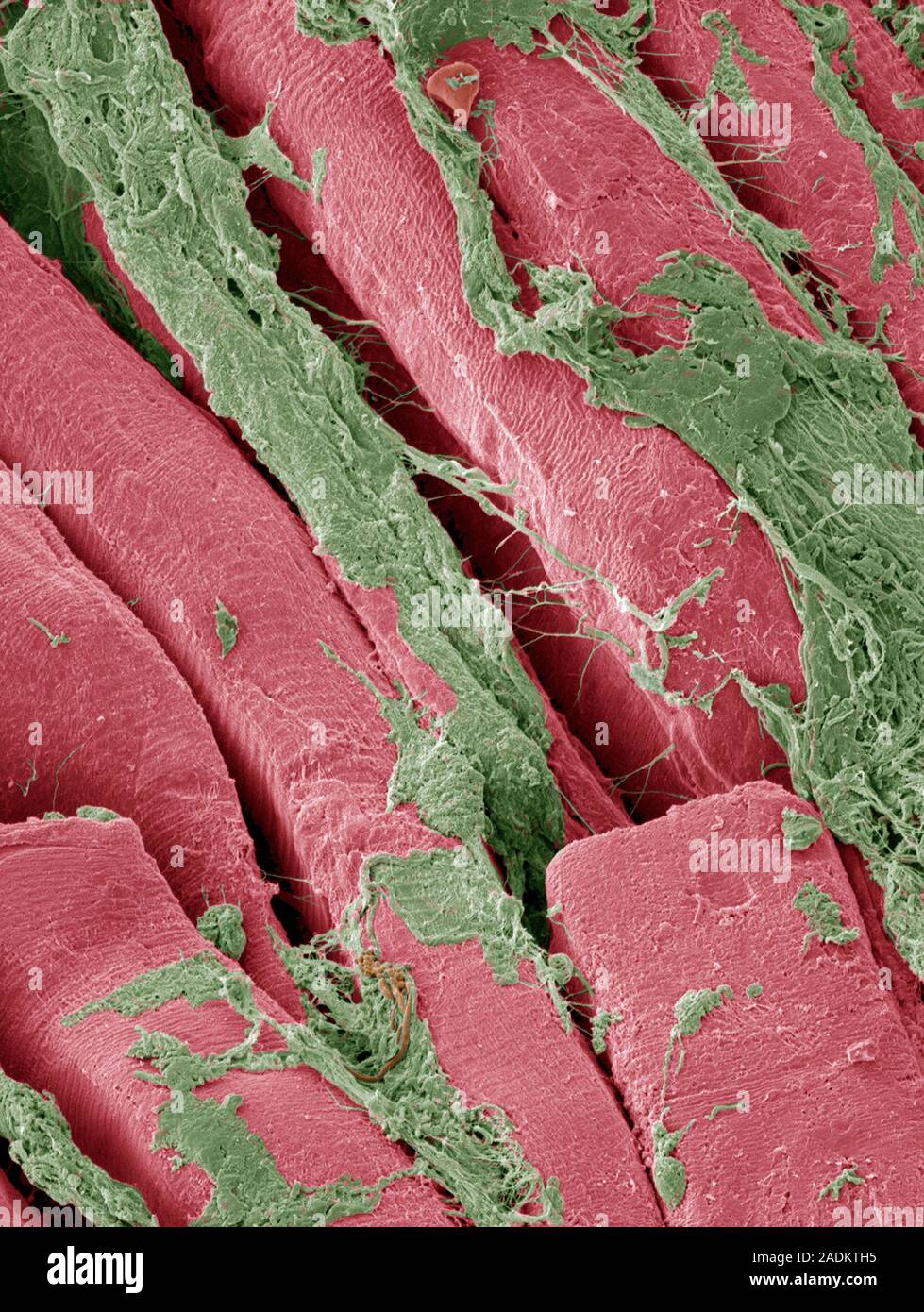 Periodontal ligament fibres. Coloured scanning electron micrograph (SEM ... Periodontal ligament fibres. Coloured scanning electron micrograph (SEM ...