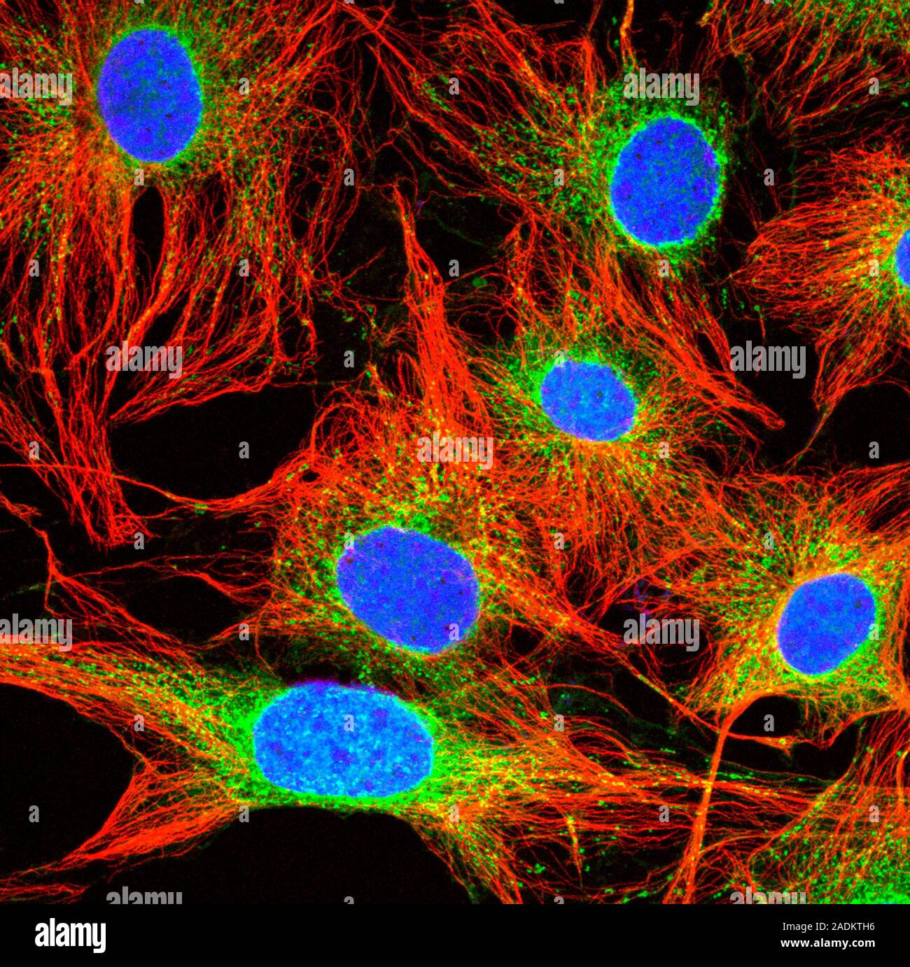 Fibroblast cells. Confocal light micrograph of fibroblast cells. The ...