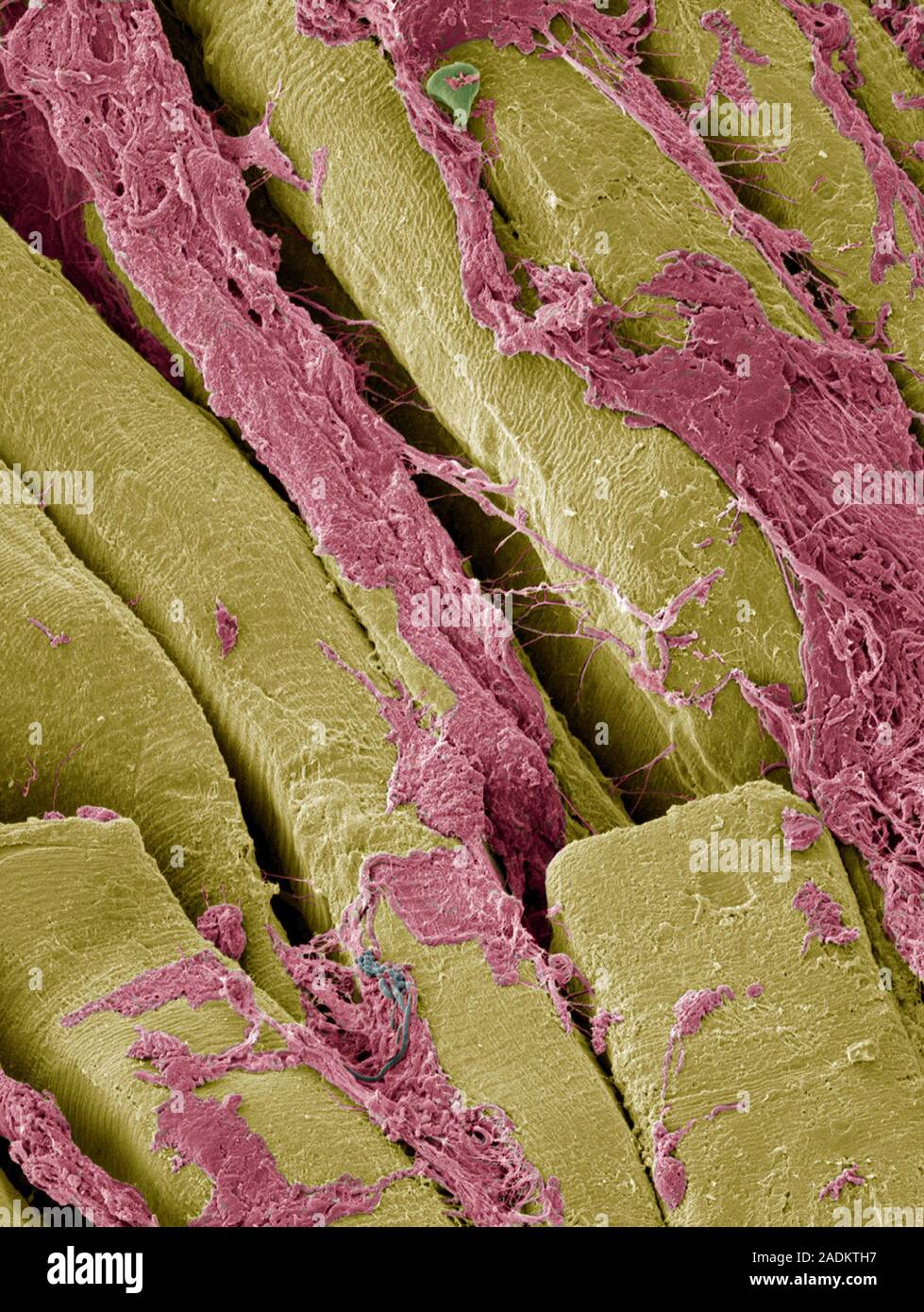 Periodontal ligament fibres. Coloured scanning electron micrograph (SEM ... Periodontal ligament fibres. Coloured scanning electron micrograph (SEM ...
