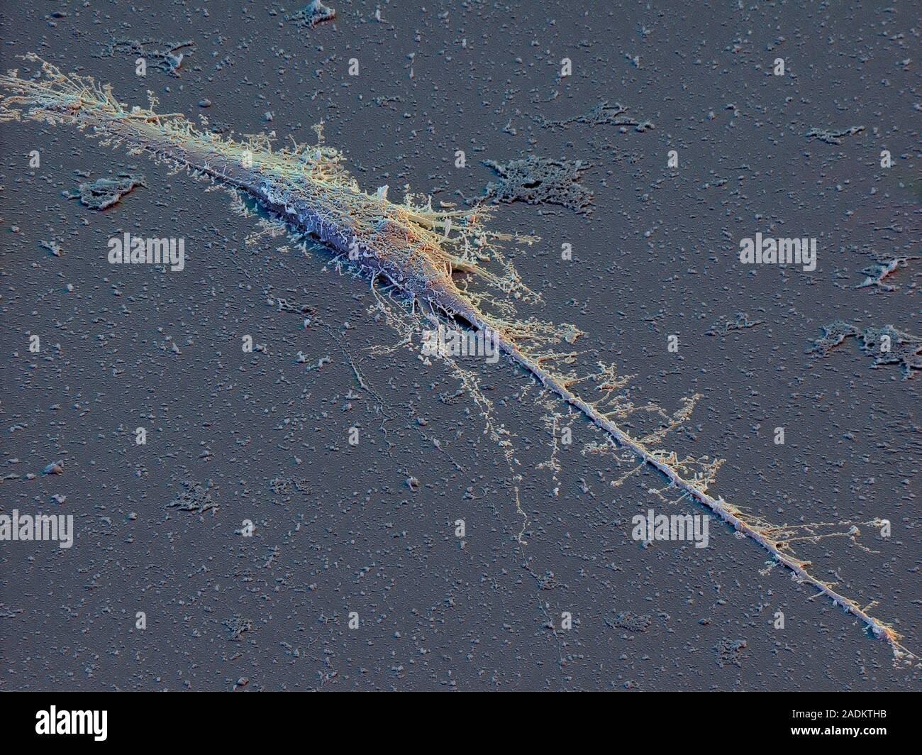 Fibroblast cell, Coloured scanning electron micrograph (SEM ...