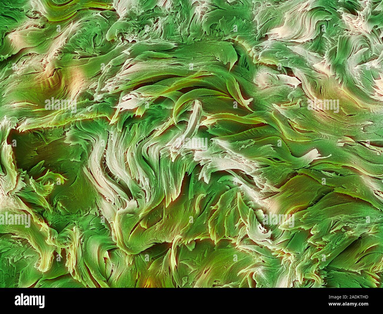 Collagen. Coloured scanning electron micrograph (SEM) of collagen ...