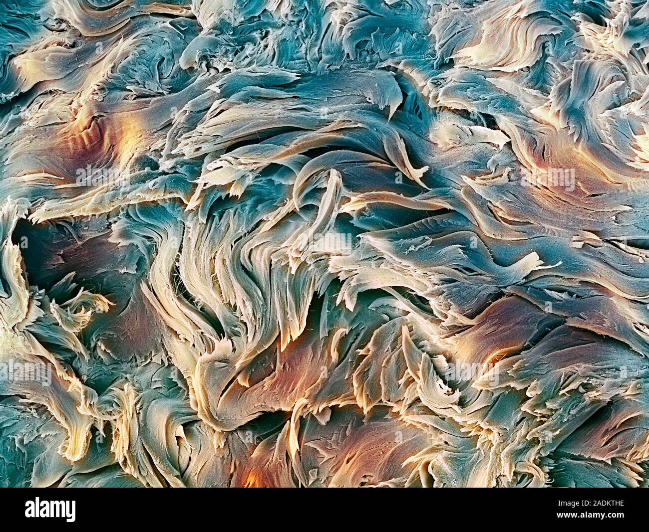 Collagen. Coloured scanning electron micrograph (SEM) of collagen ...