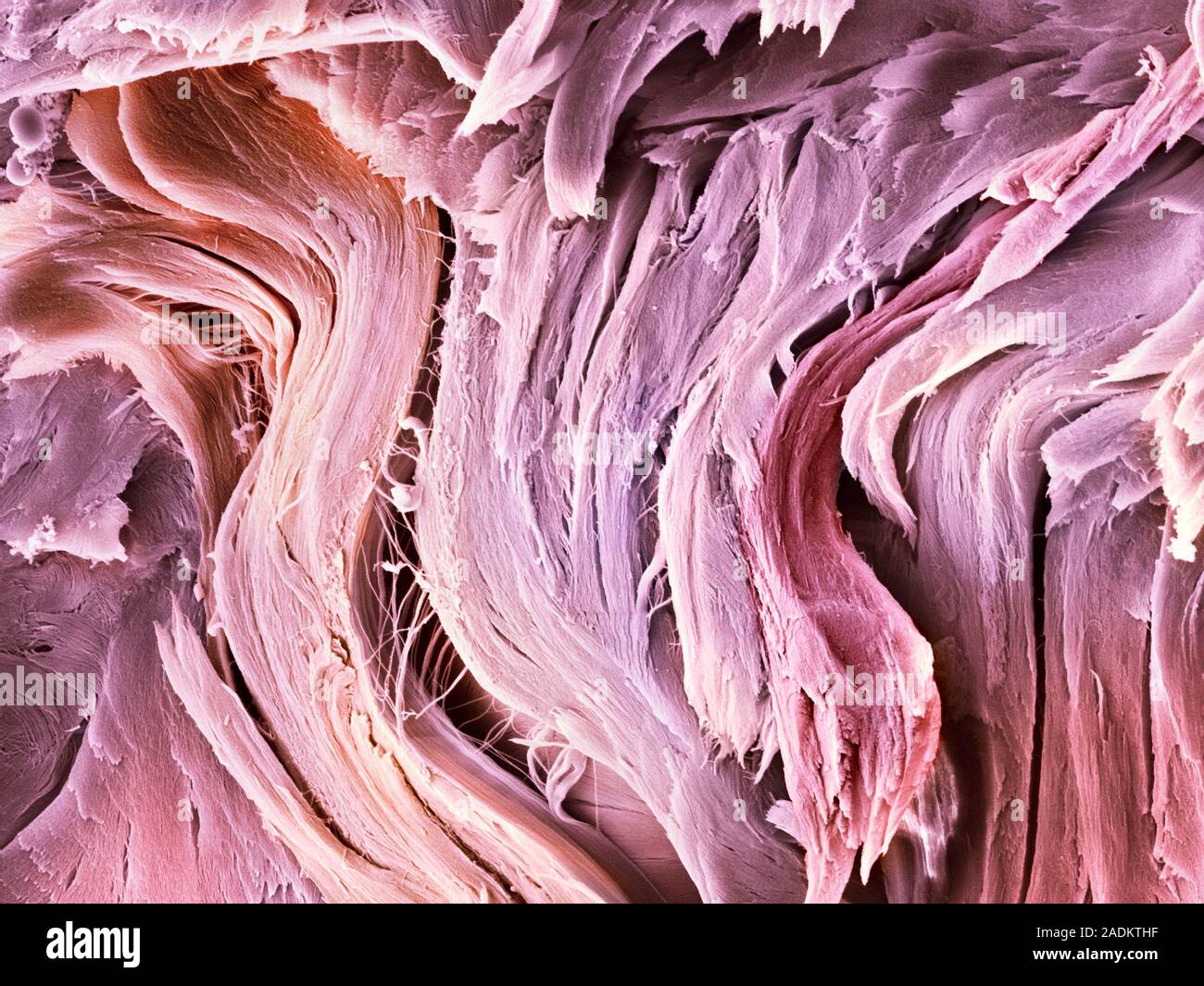 Collagen. Coloured scanning electron micrograph (SEM) of collagen ...