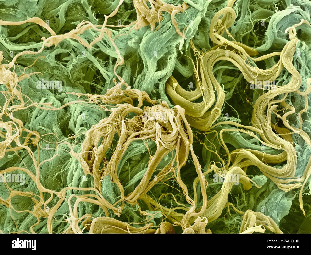 Collagen fibres. Coloured scanning electron micrograph (SEM) of ...