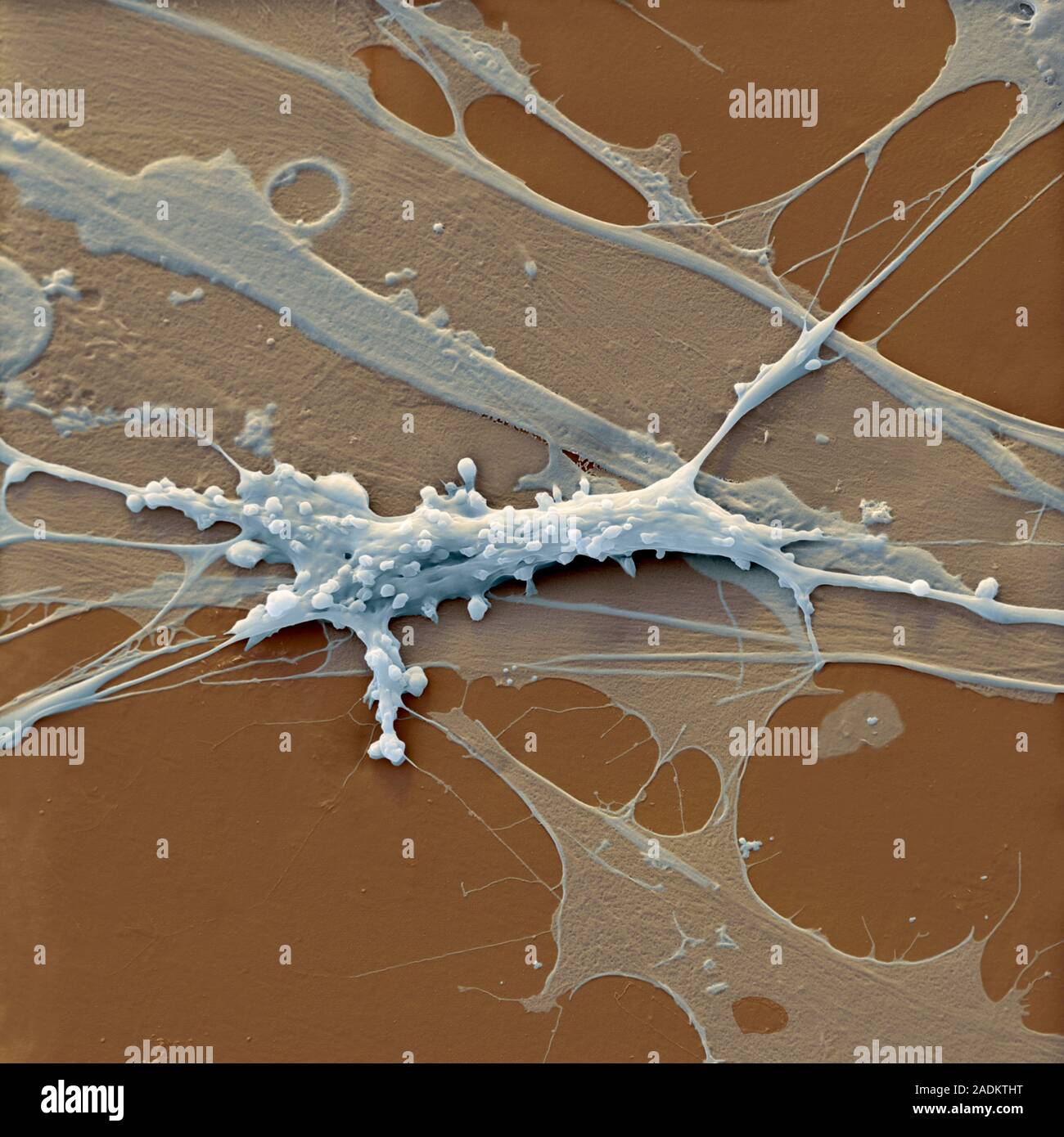 Fibroblast cell, coloured scanning electron micrograph (SEM ...