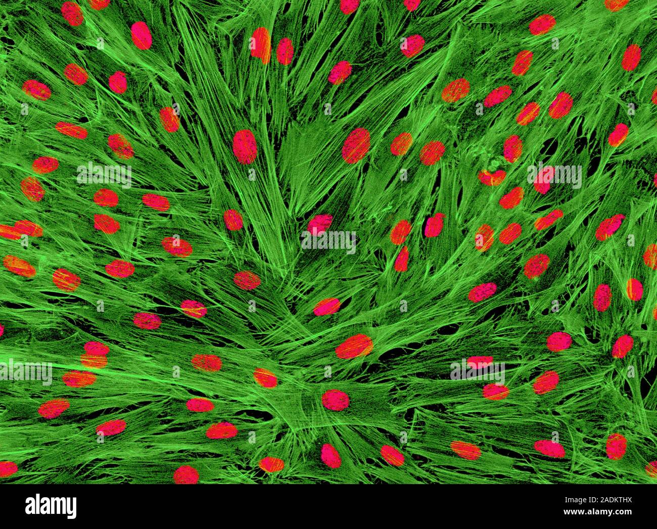 Fibroblast cells. Confocal light micrograph of human fibroblast cells ...