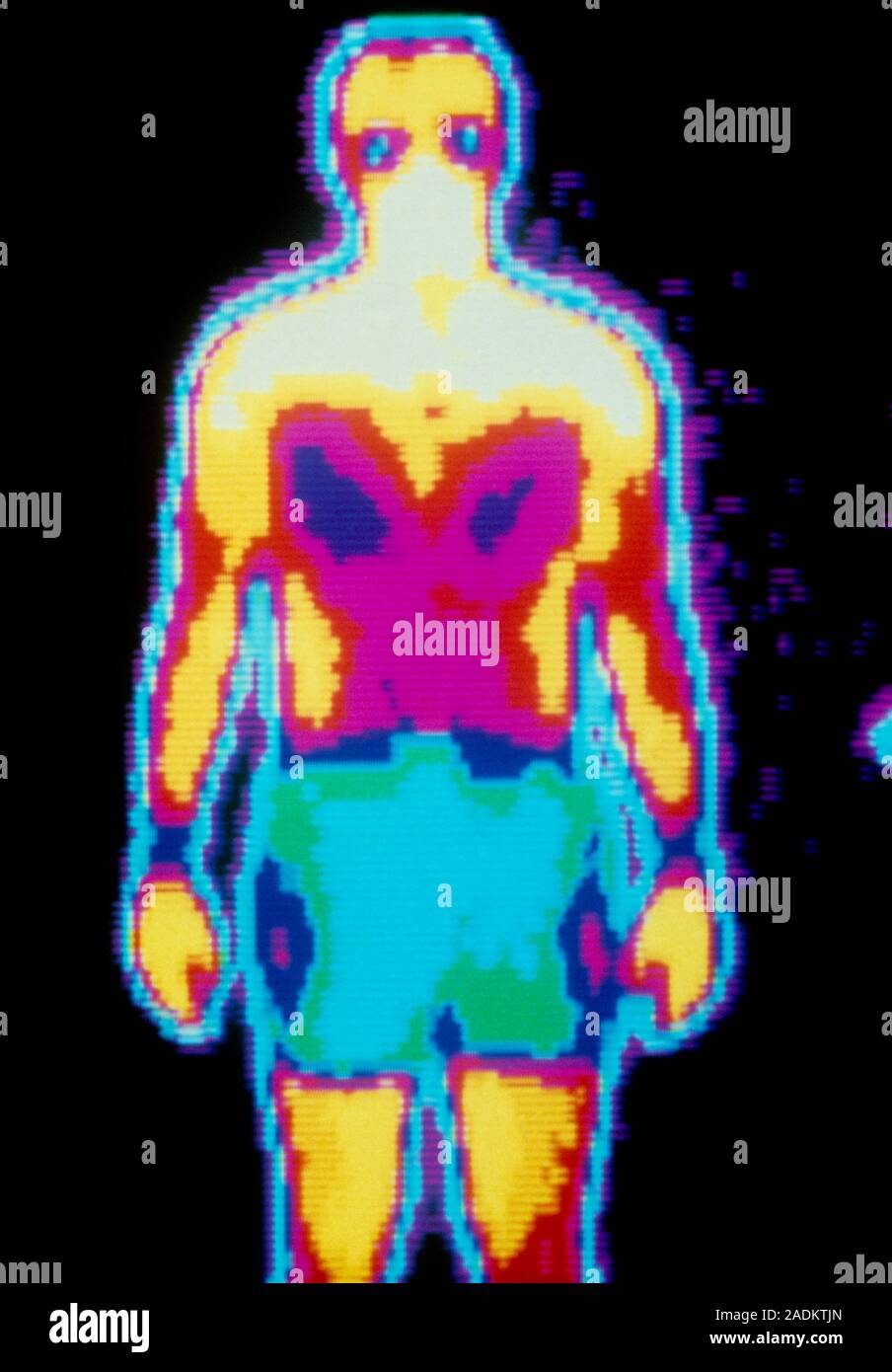 Thermogram of a man. Thermogram of the body of a standing man. A ...