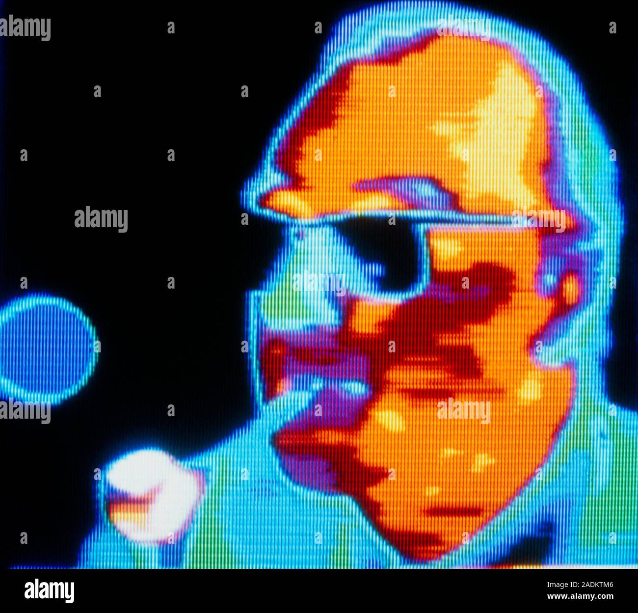 Thermogram of a man smoking a pipe, showing an increase in facial skin ...