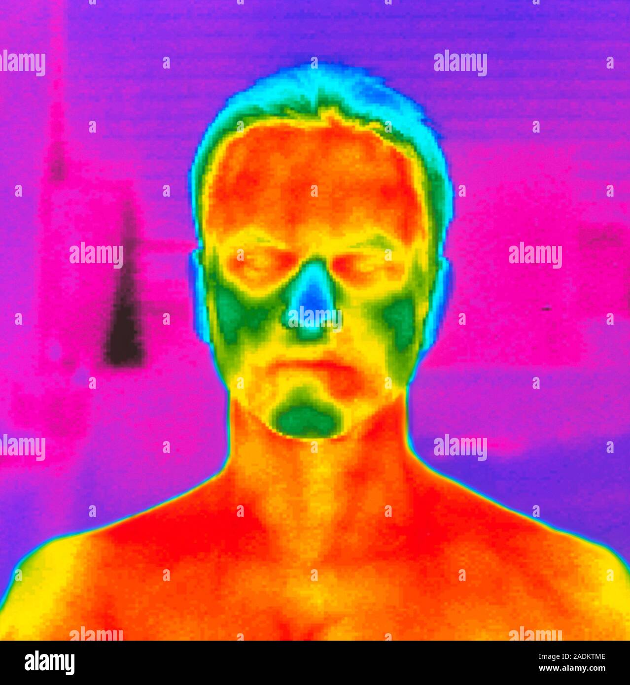 Head and shoulders. Thermogram of a man's head and shoulders, showing ...