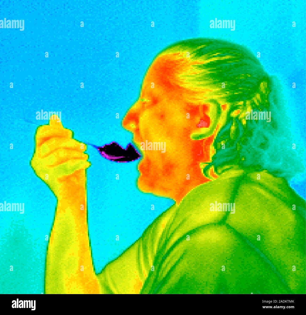 Eating ice cream. Thermogram of a woman eating ice cream, showing the ...