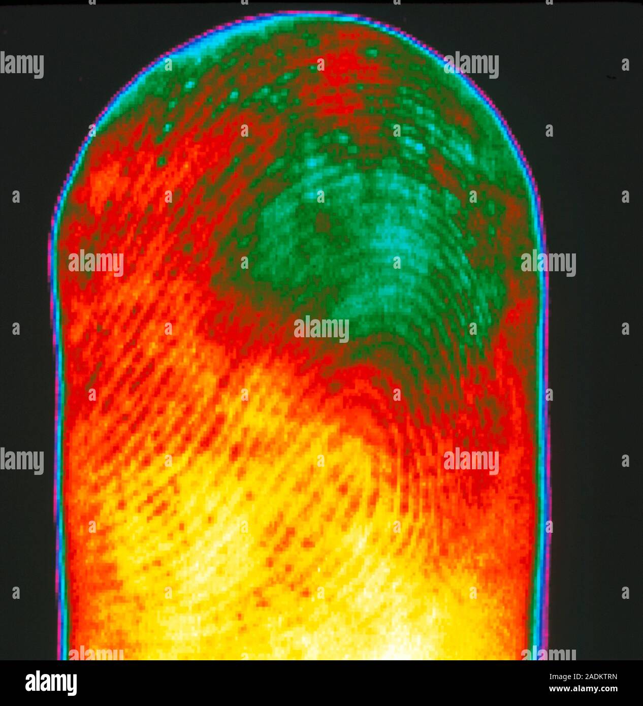 Finger. Thermogram of a close-up of a human finger, showing the ...