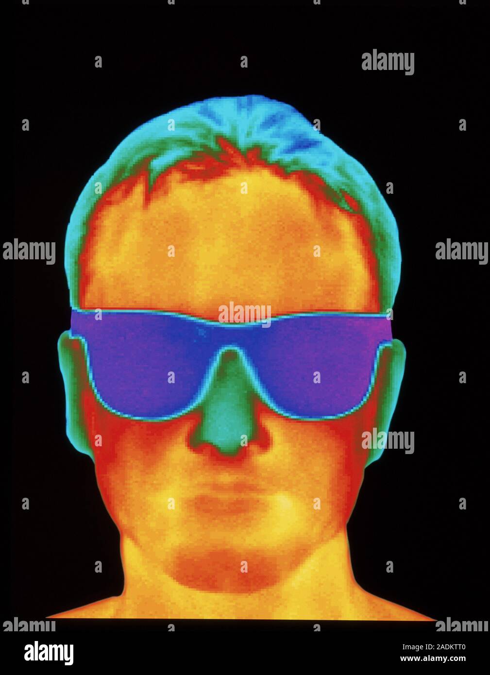 Man wearing glasses. Thermogram of the head of a man wearing glasses ...
