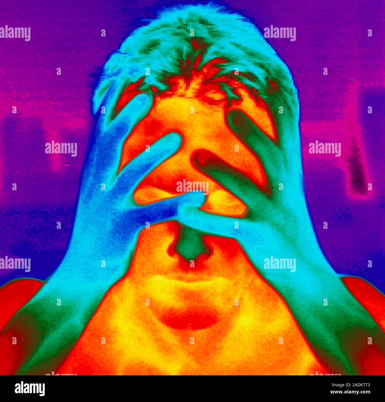 Head in hands. Thermogram of a man's holding his head in his hands. The ...