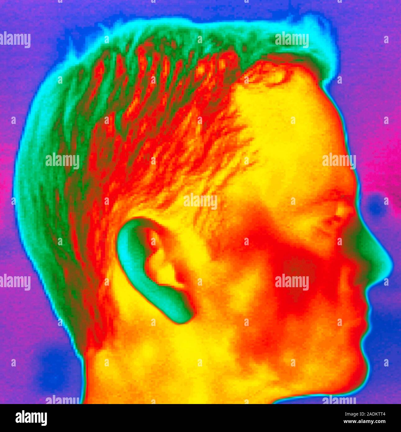 Head. Thermogram of a man's head in profile showing variation in ...