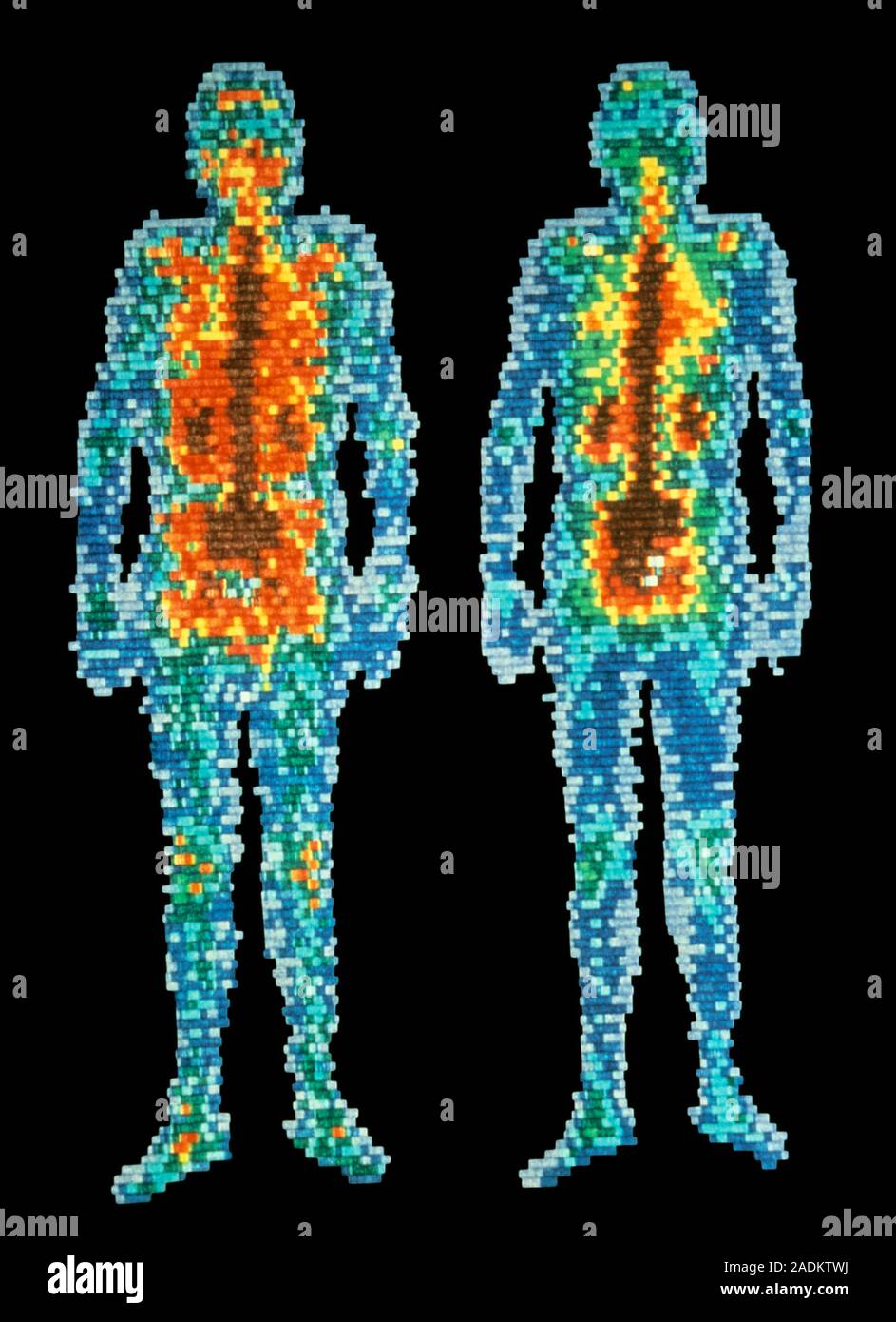 Full-body scans of a healthy man injected with a radioactive isotope ...
