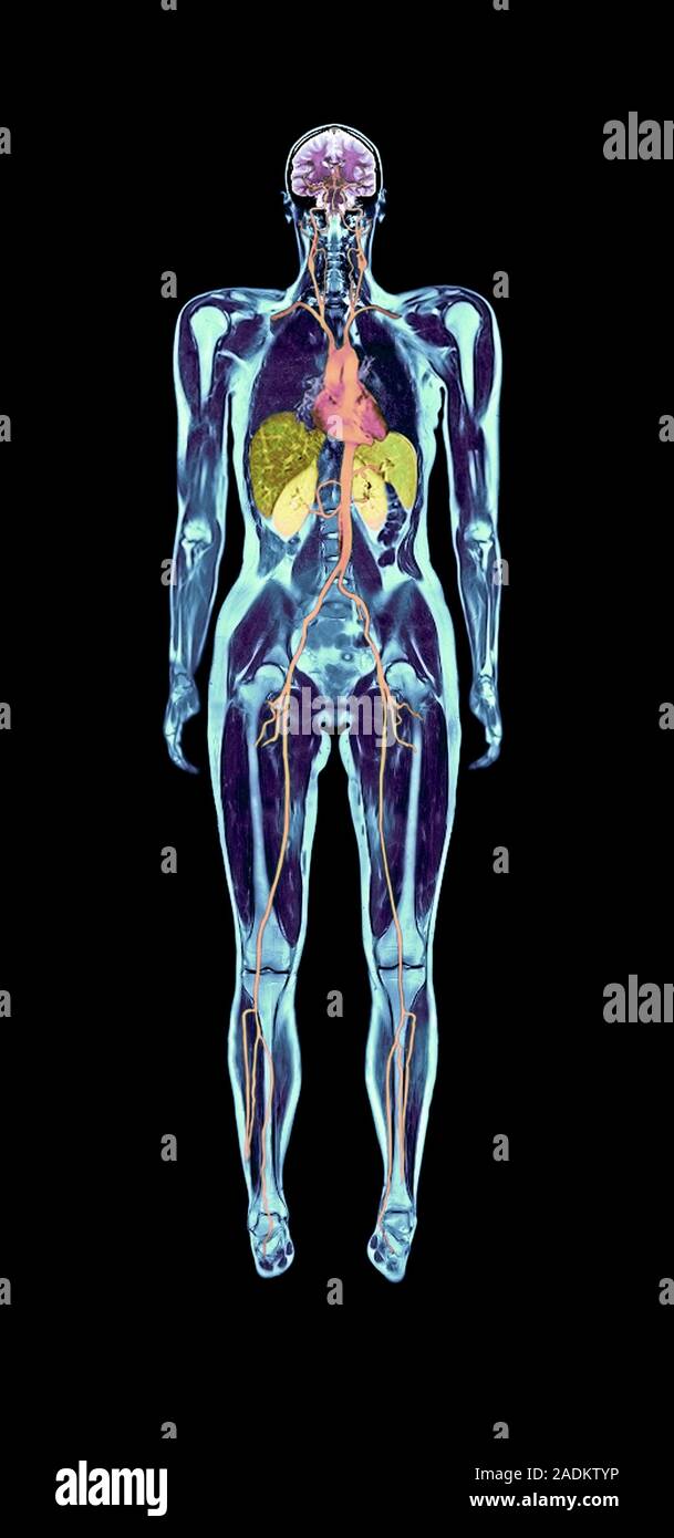 Full body scan of a female swimmer. Her brain is purple (top), her ...