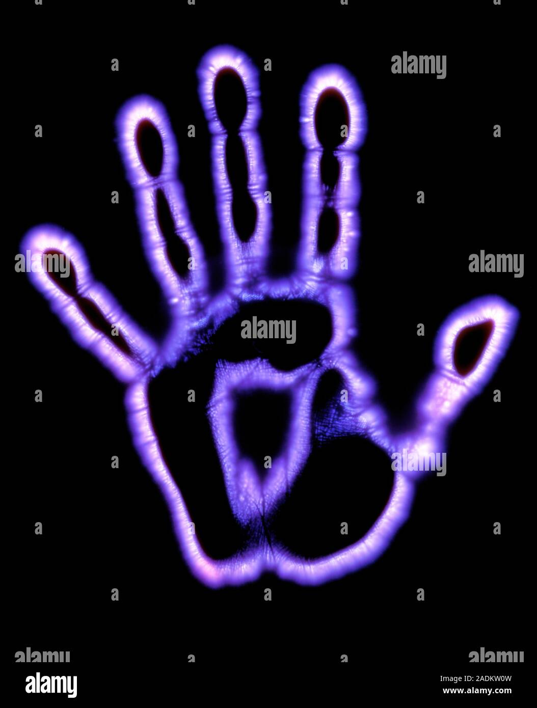 Hand. Kirlian photograph of a human hand showing the electromagnetic ...