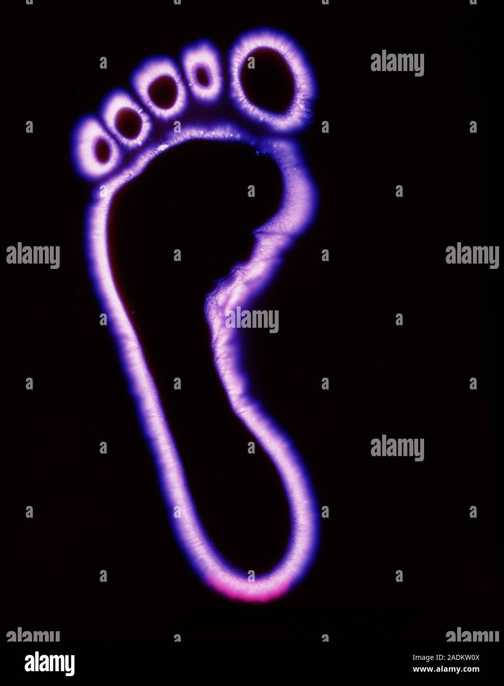 Foot. Kirlian photograph of a human foot showing the electromagnetic ...