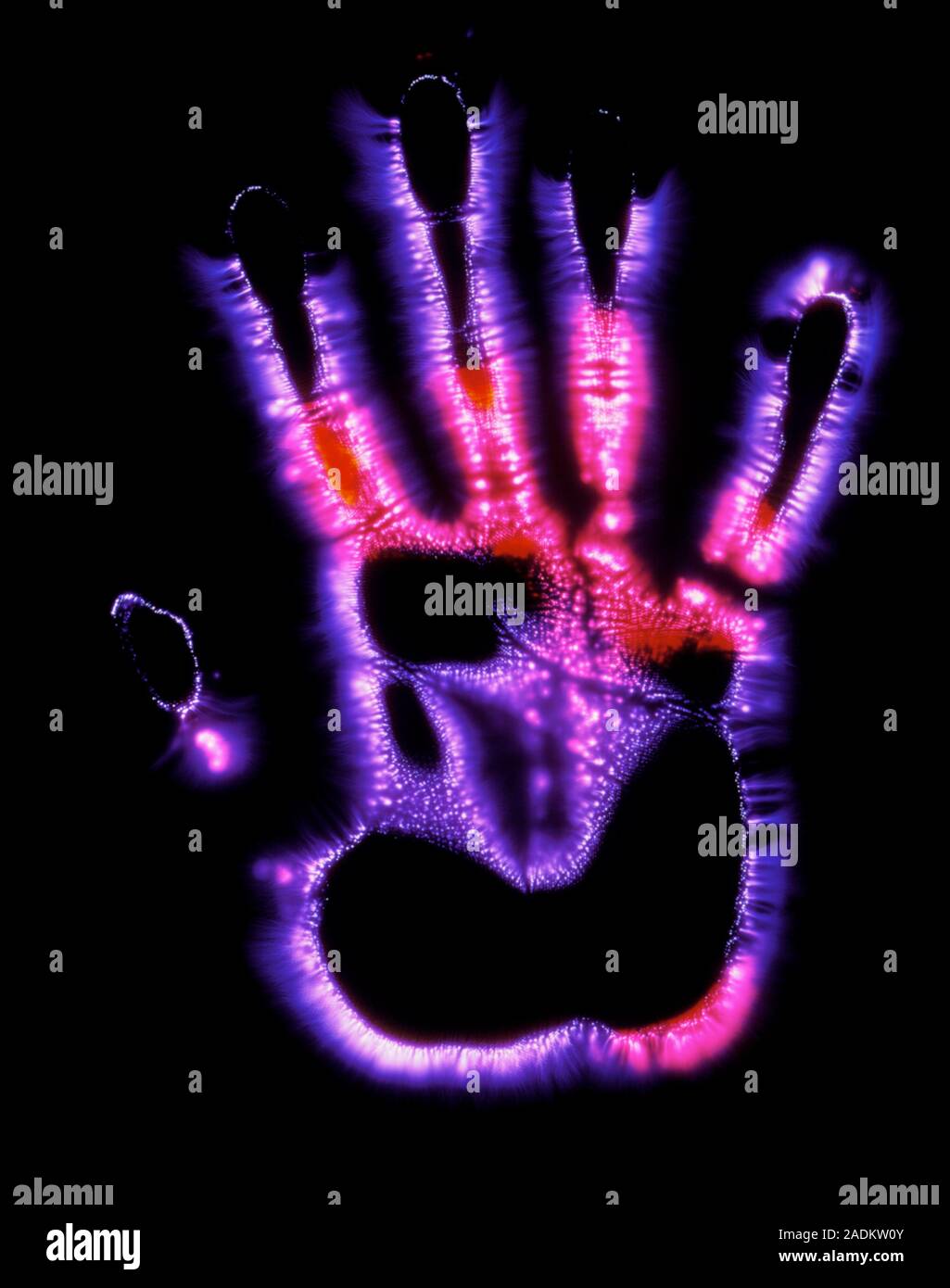 Hand. Kirlian photograph of a human hand showing the electromagnetic ...