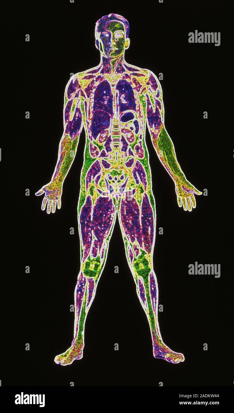 Male body sectioned. Computer coloured front view of the male human ...